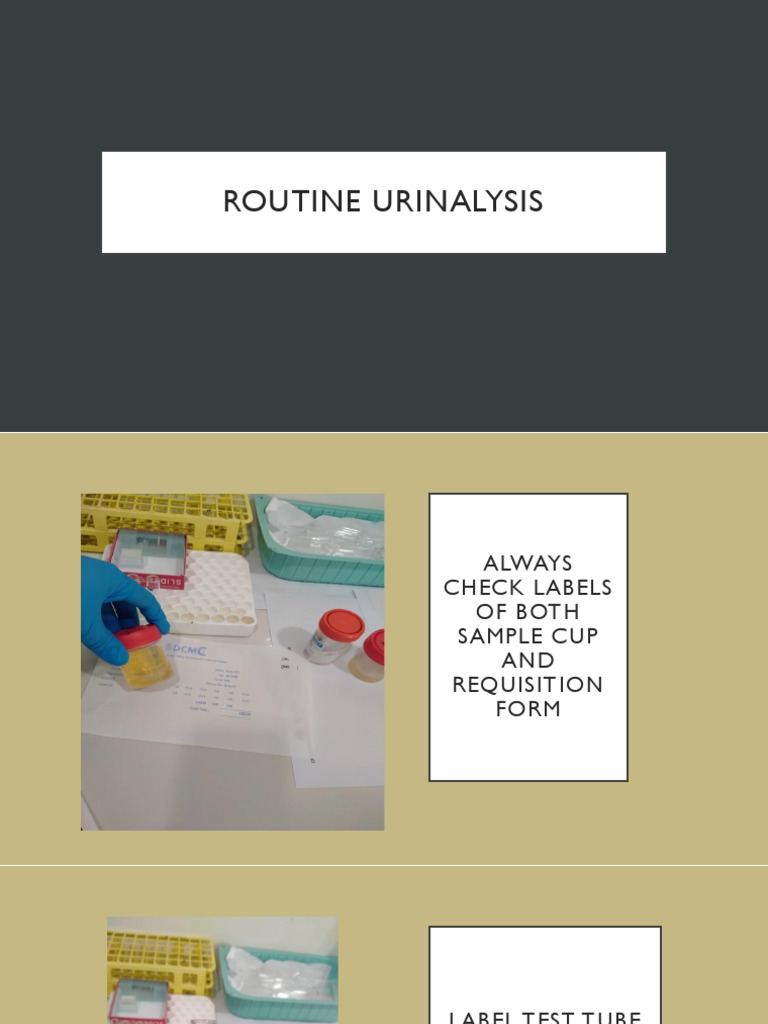 Urinalysis and Fecalysis | PDF