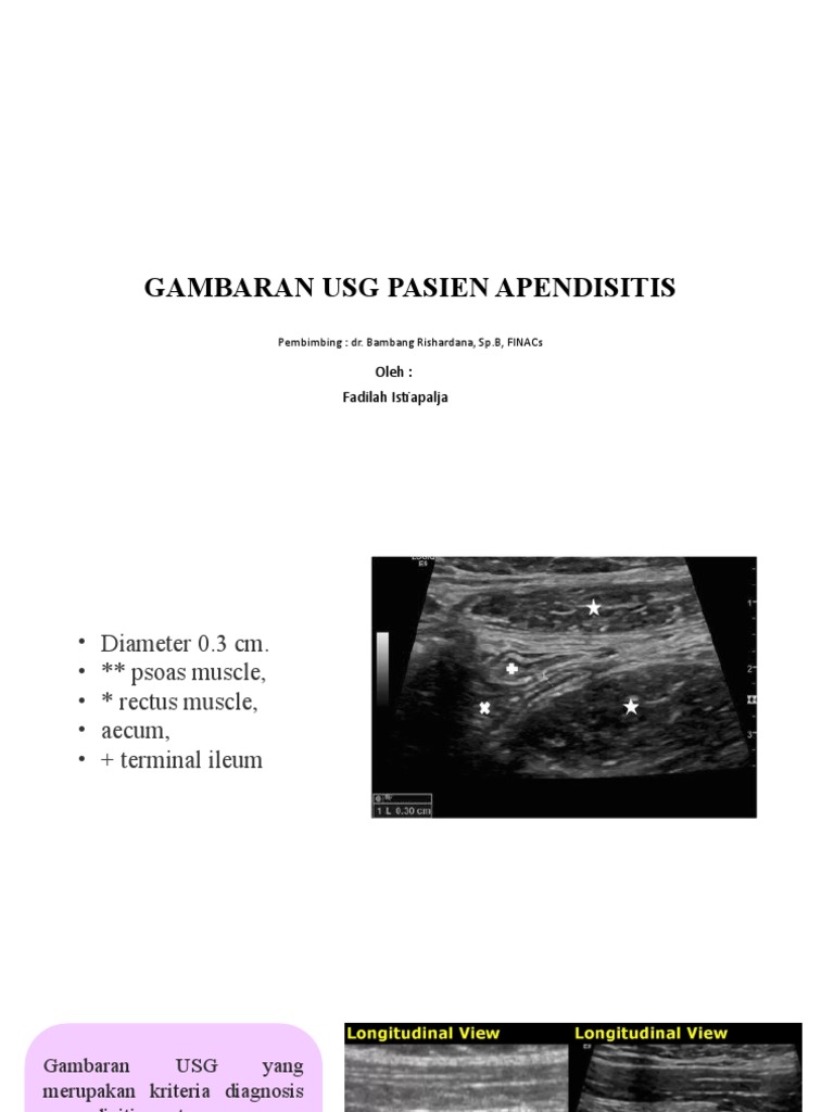 Tugas Tambahan Usg Pada Apendisitis | PDF