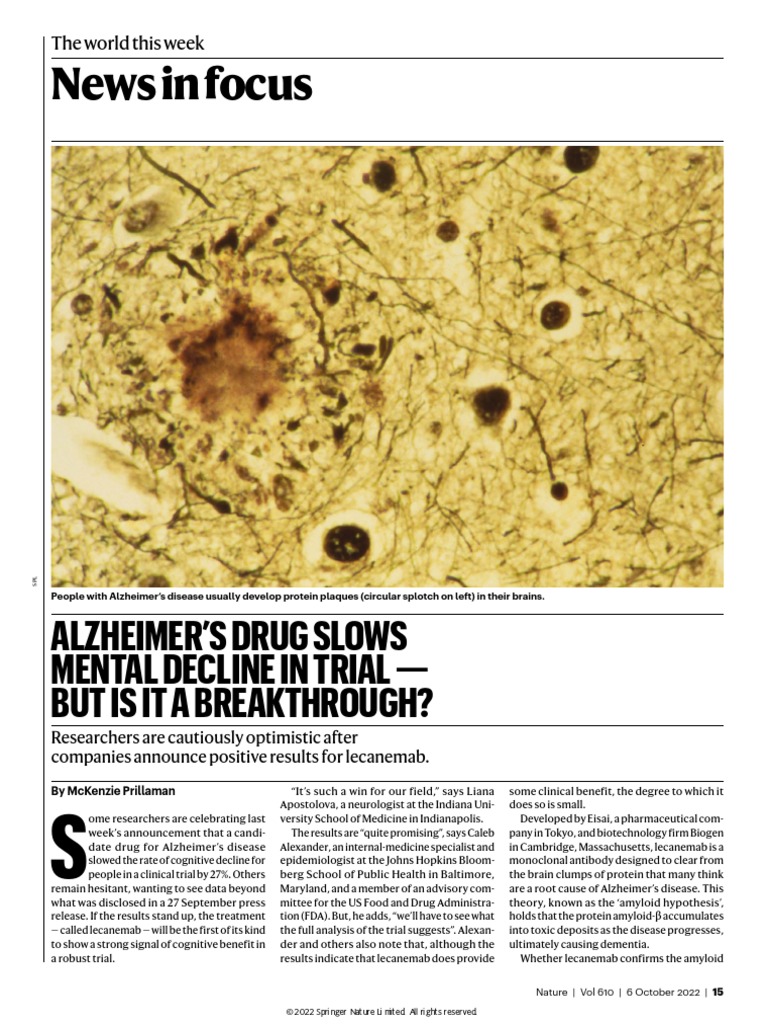 News in Focus: Alzheimer'S Drug Slows Mental Decline in Trial - But Is ...