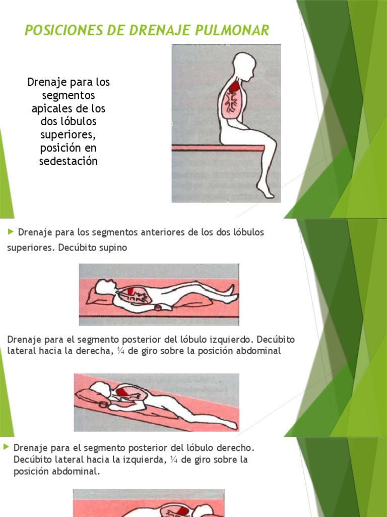 Posiciones de Drenaje Pulmonar | PDF