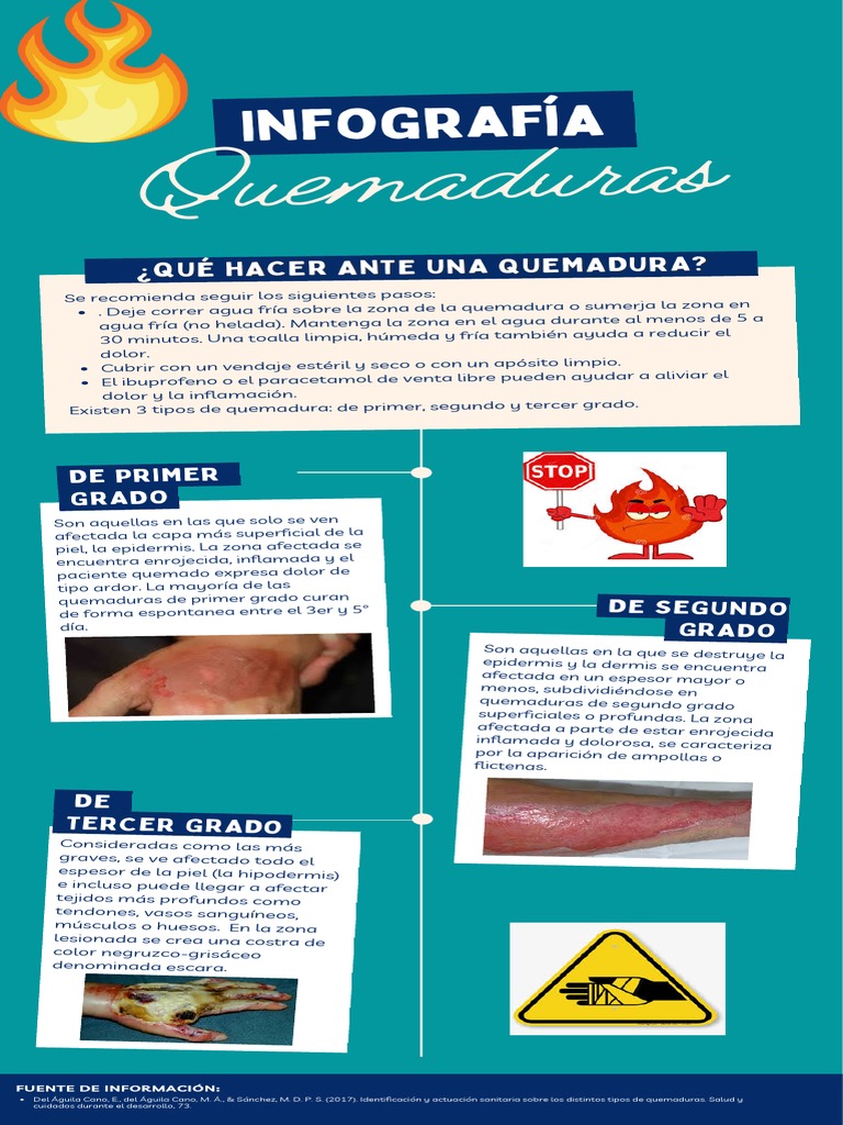 Infografía sobre quemaduras | PDF | Quemar | Piel