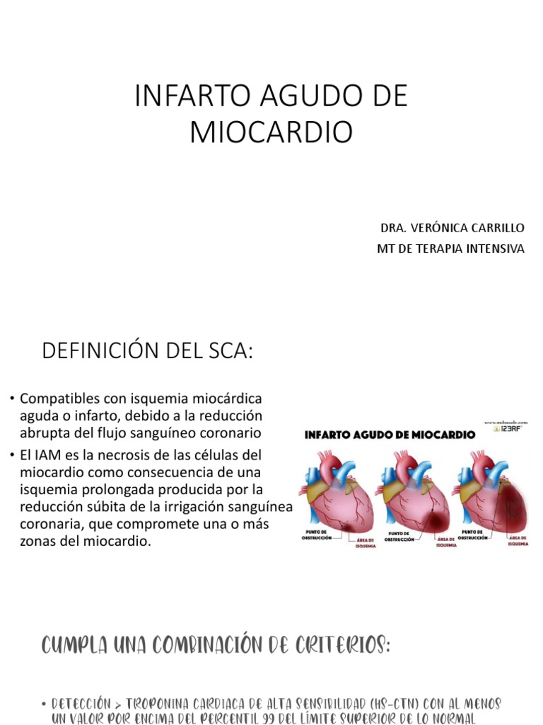 3 Infarto Agudo de Miocardio Presentacion | PDF | Infarto de miocardio ...