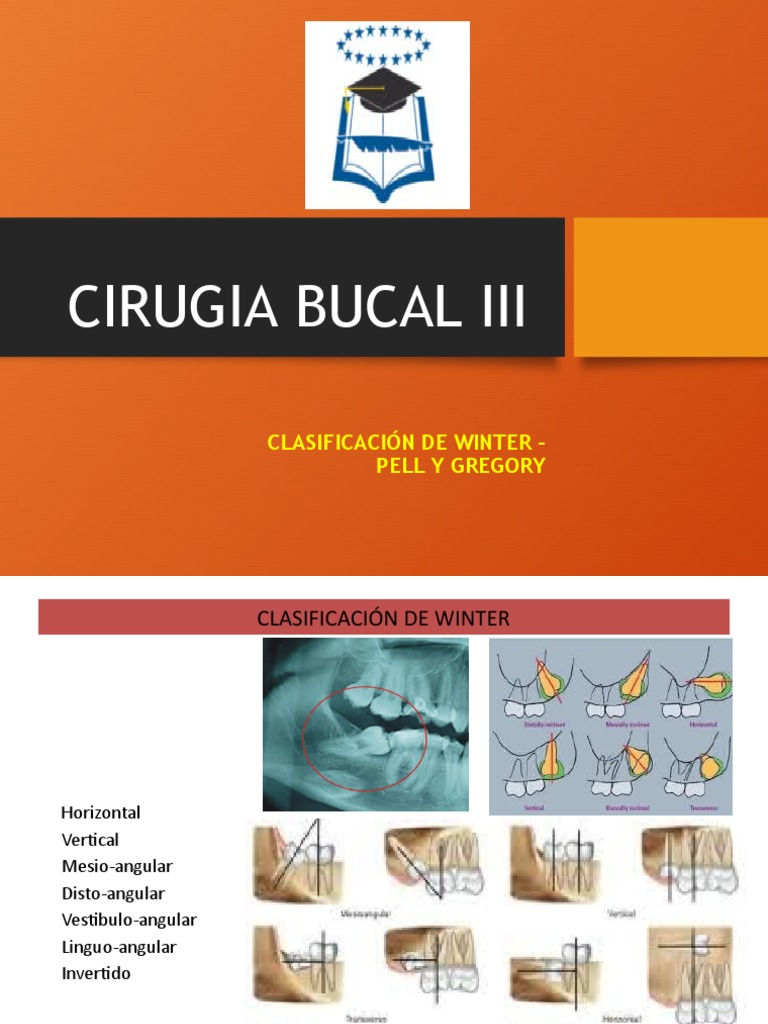 Clasificación Pell y Gregory en Terceros Molares | PDF | Ciencia y ...