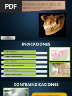 Clasificación Pell y Gregory en Terceros Molares | PDF | Ciencia y ...