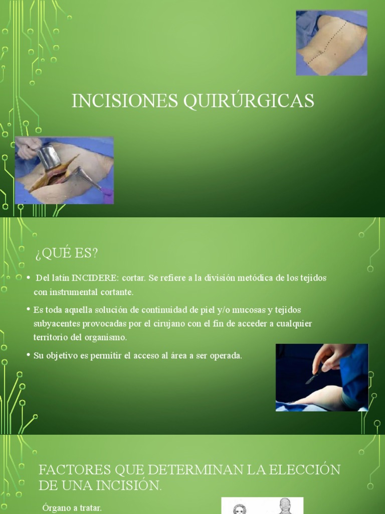 Incisiones QX | PDF