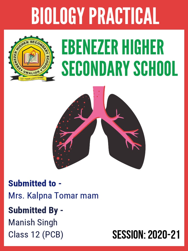 Class 12 Biology Project on AIDS | PDF