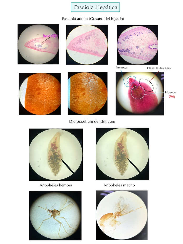Fasciola Hepática | PDF