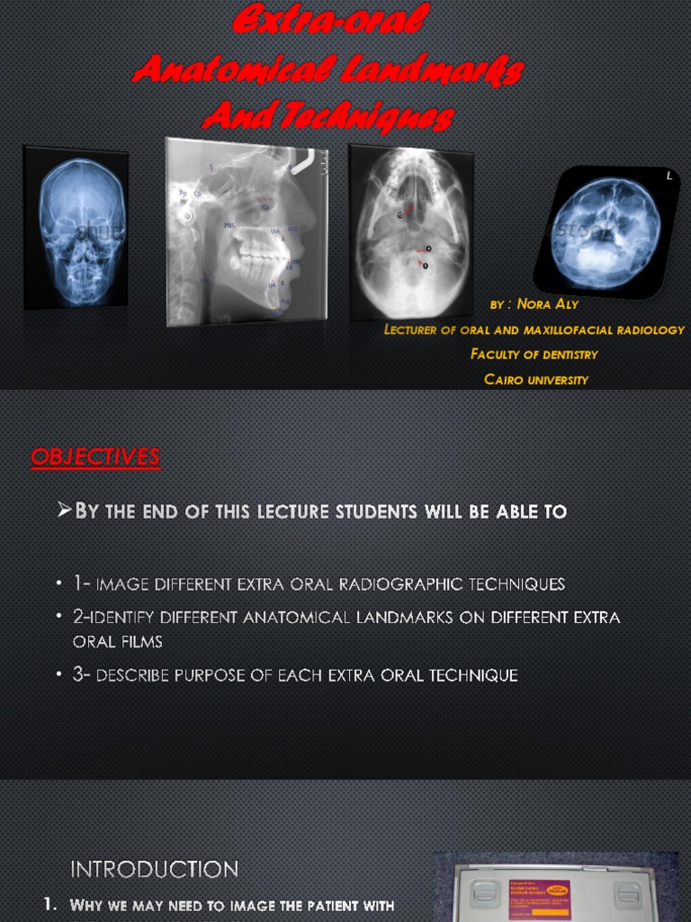 Extra Oral Landmarks by Nora Aly PDF | PDF | Skull | Human Head And Neck