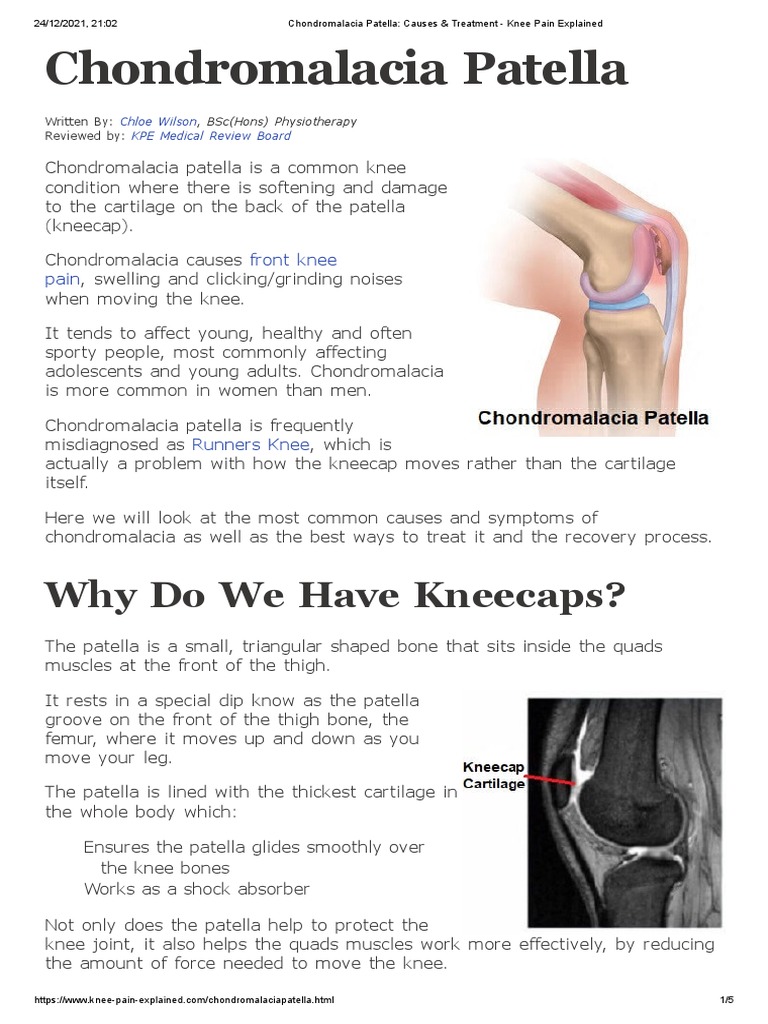 Chondromalacia Patella: Causes & Care | PDF | Knee | Limbs (Anatomy)