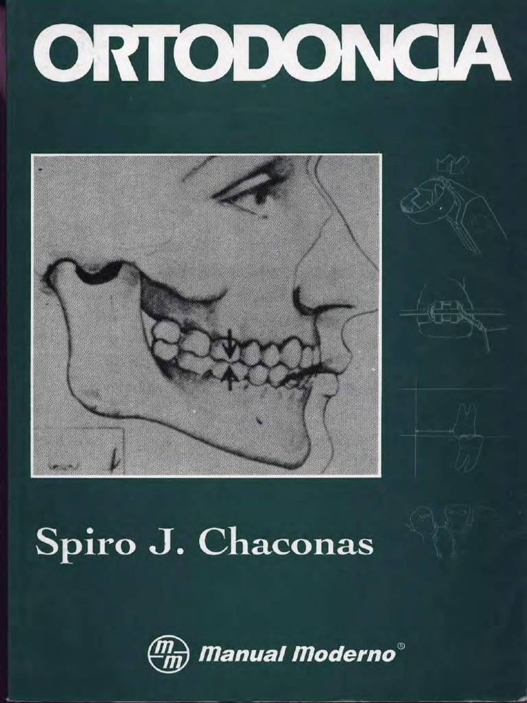CHACONAS - Ortodoncia | PDF
