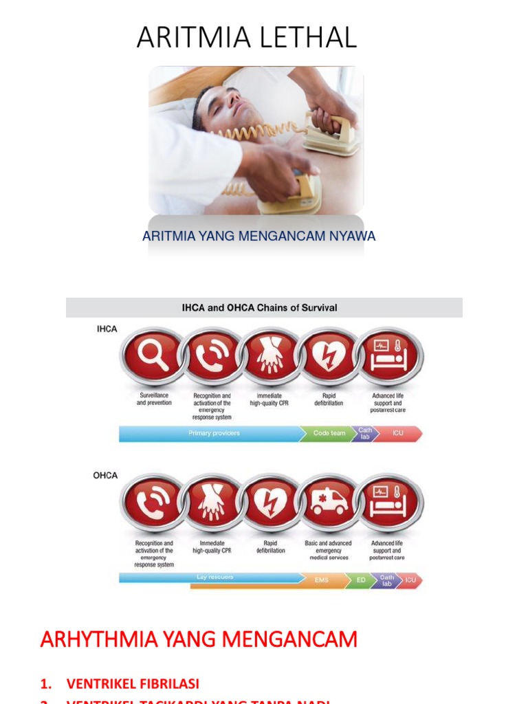 Aritmia Lethal | PDF