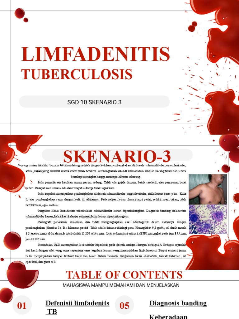 Limfadenitis TB | PDF