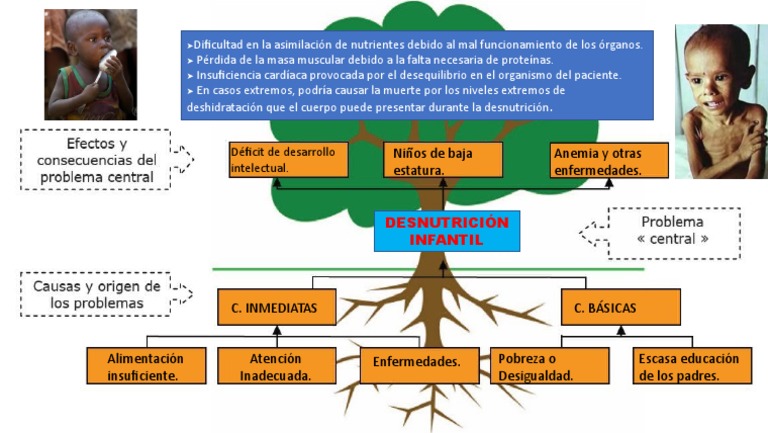 Desnutricion Infantil Pdf