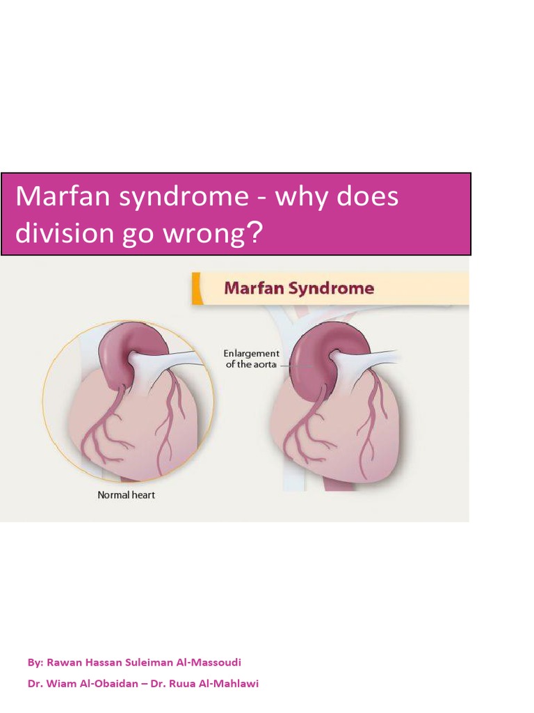 Marfan Syndrome | PDF | Heart | Aorta