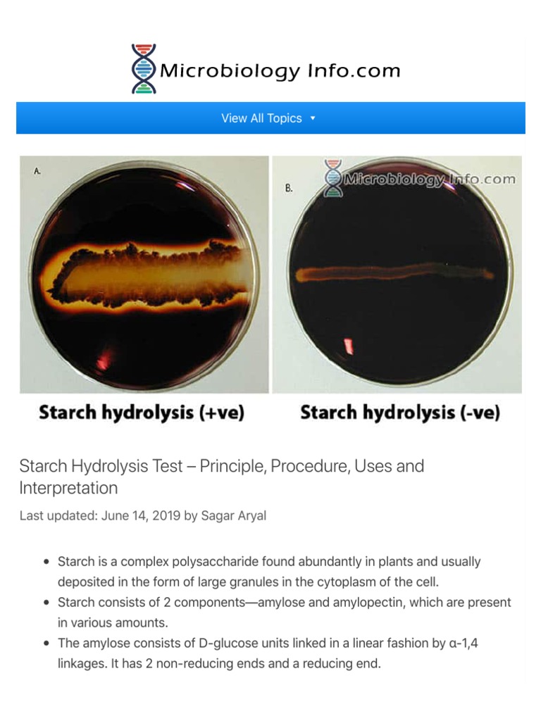 Starch Hydrolysis Test - Principle, Procedure, Us | PDF | Starch ...