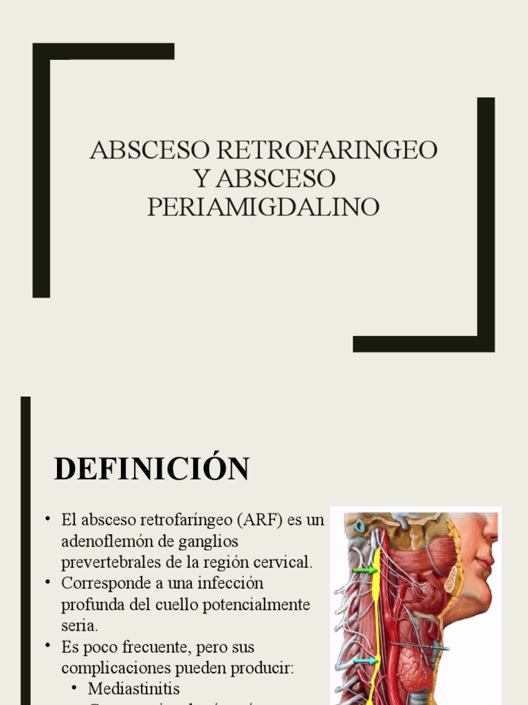 Absceso Periamigdalino 1 | PDF | Inmunología | Causas de la muerte