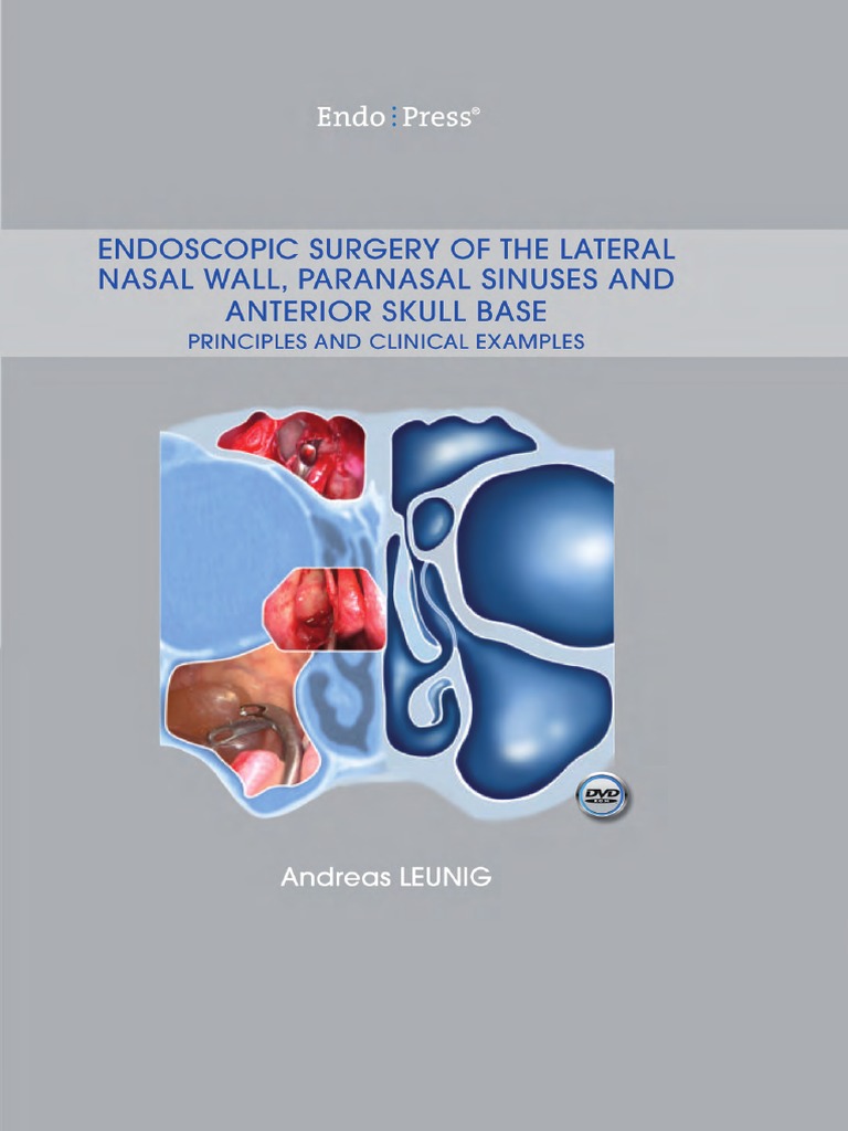 Endoscopic Surgery of The Lateral Nasal Wall, Paranasal Sinuses, and Anterior Skull Base ...