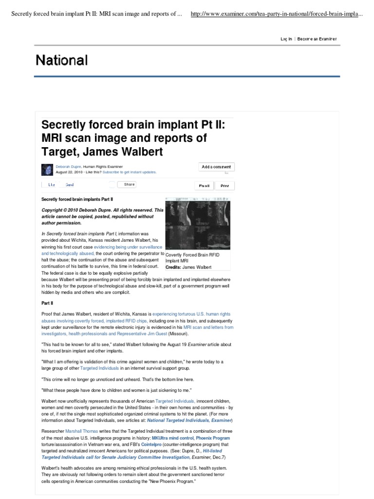 James Walbert - Secretly Forced Brain Implant PT II | PDF | Patriot Act ...