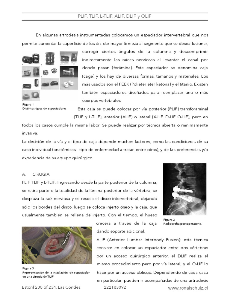 Plif Tlif L Tlif Alif D Lif o Lif | PDF | La columna vertebral | Cirugía