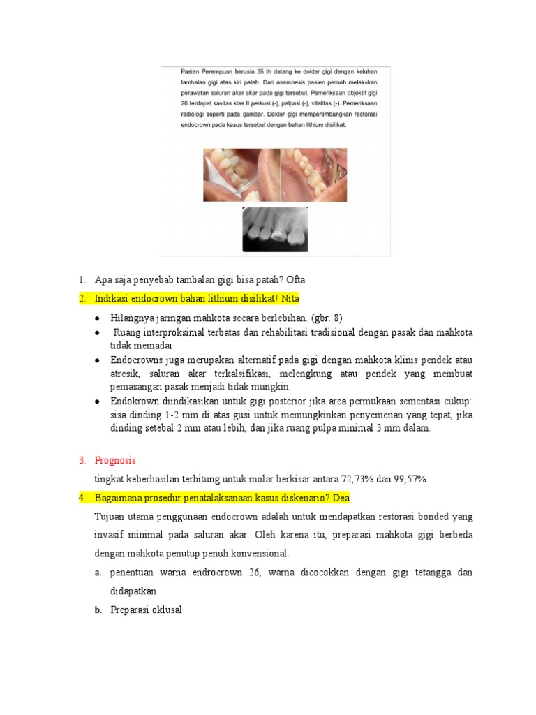 Prior LBM 4 Saskia | PDF