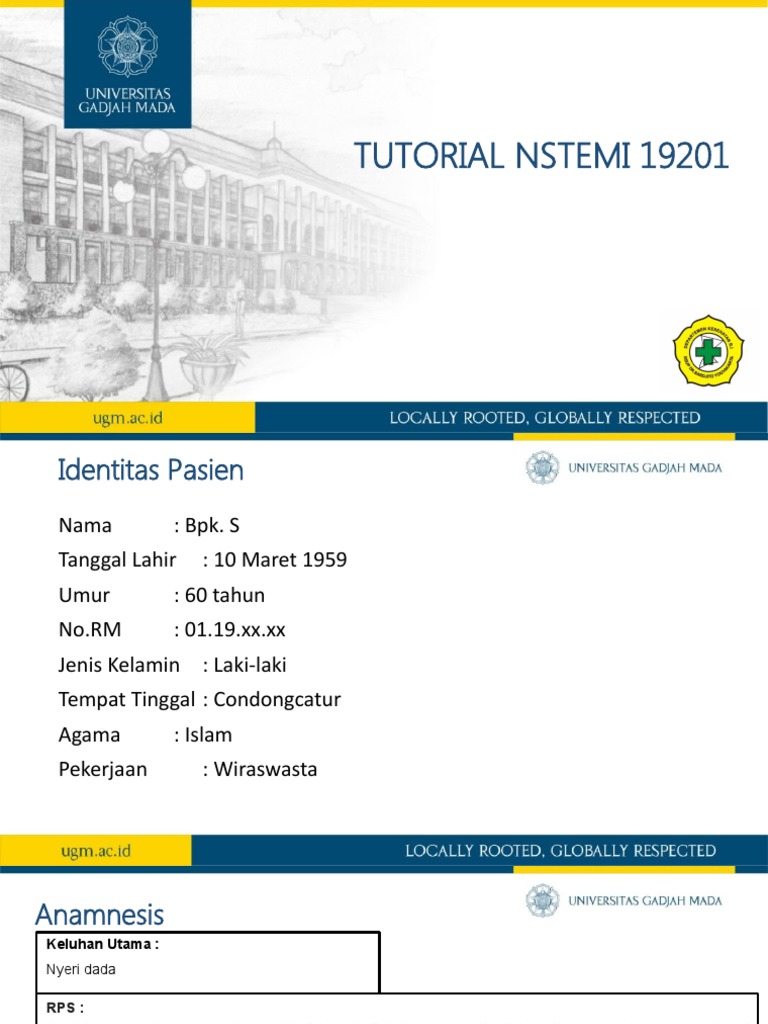 Nstemi 19201 | PDF