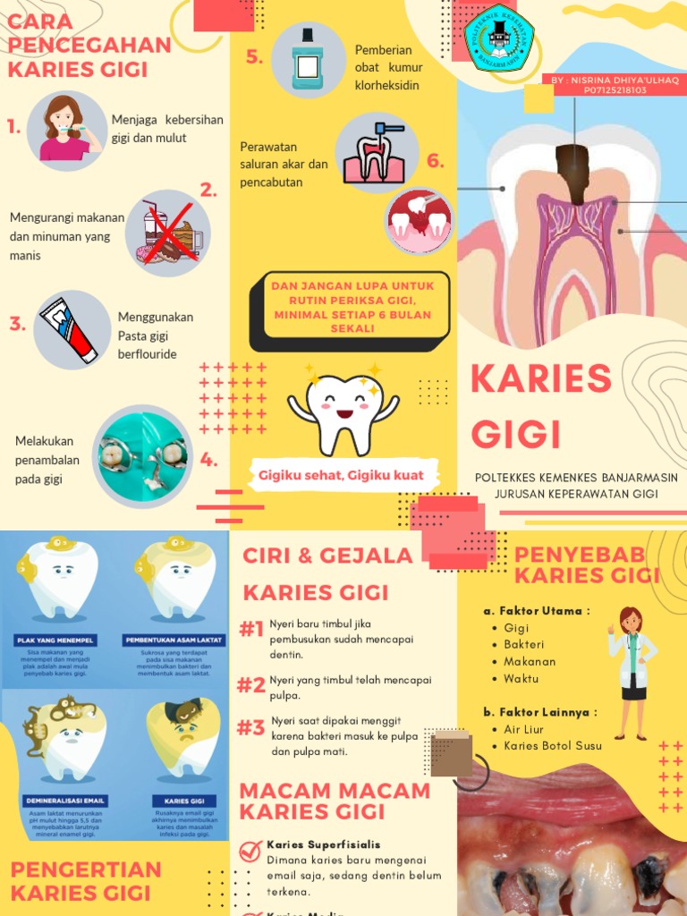Karies Gigi | PDF