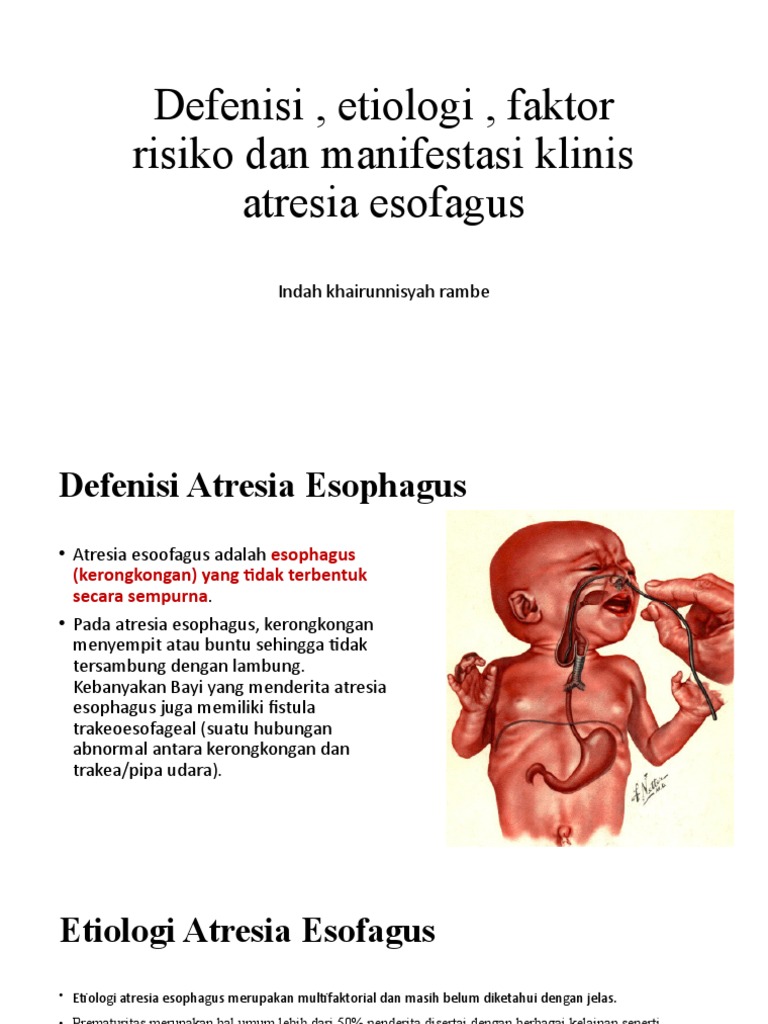 Atresia Esofagus - Indah | PDF