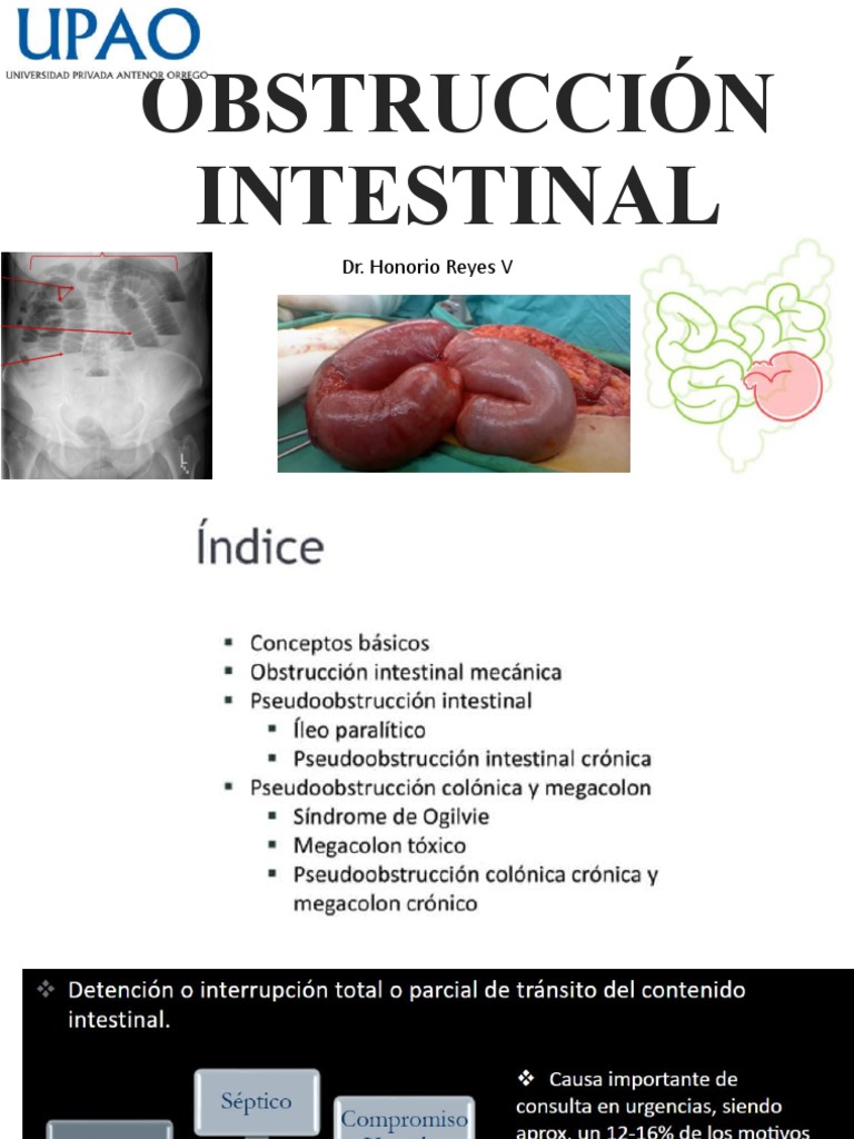 Obstrucción Intestinal: Clasificación y Fisiopatología | PDF
