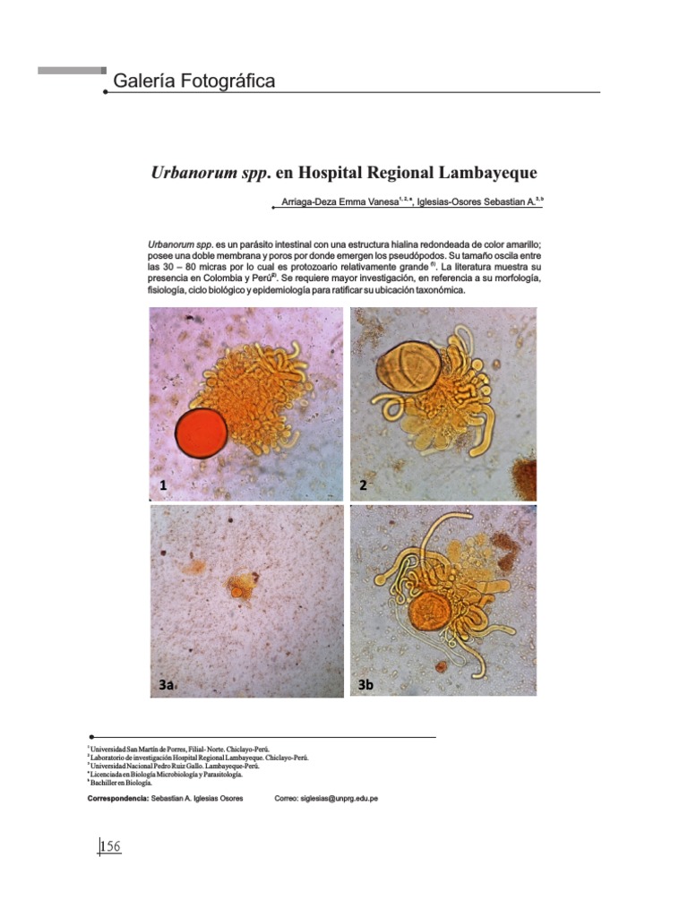 Urbanorum spp.: Parásito intestinal en Perú | PDF | Microbiología ...
