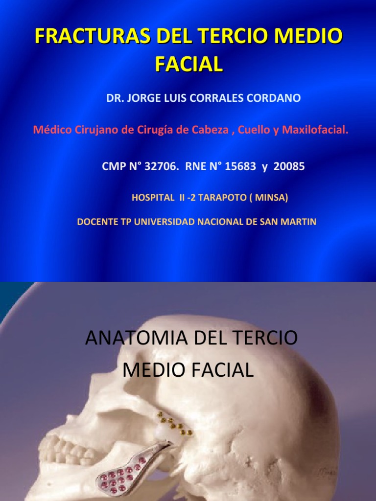 Fracturas del Tercio Medio Facial | PDF | Cabeza y cuello humanos ...