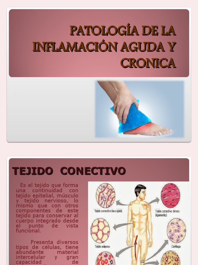 Patologia de La Inflamación | PDF | Inflamación | Tejido conectivo