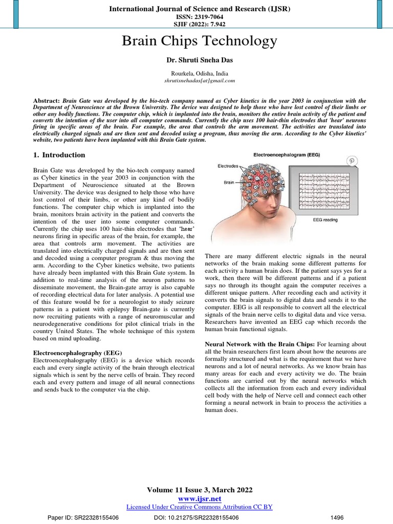 Brain Chip | PDF | Electroencephalography | Brain