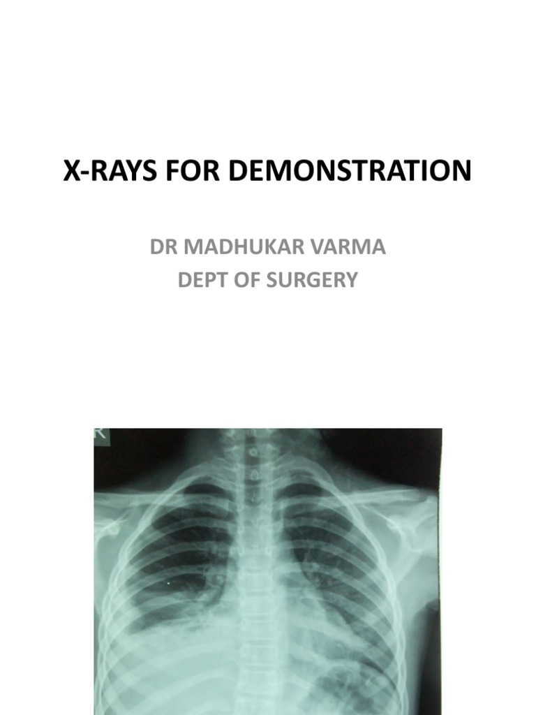 Xrays Surgery | PDF