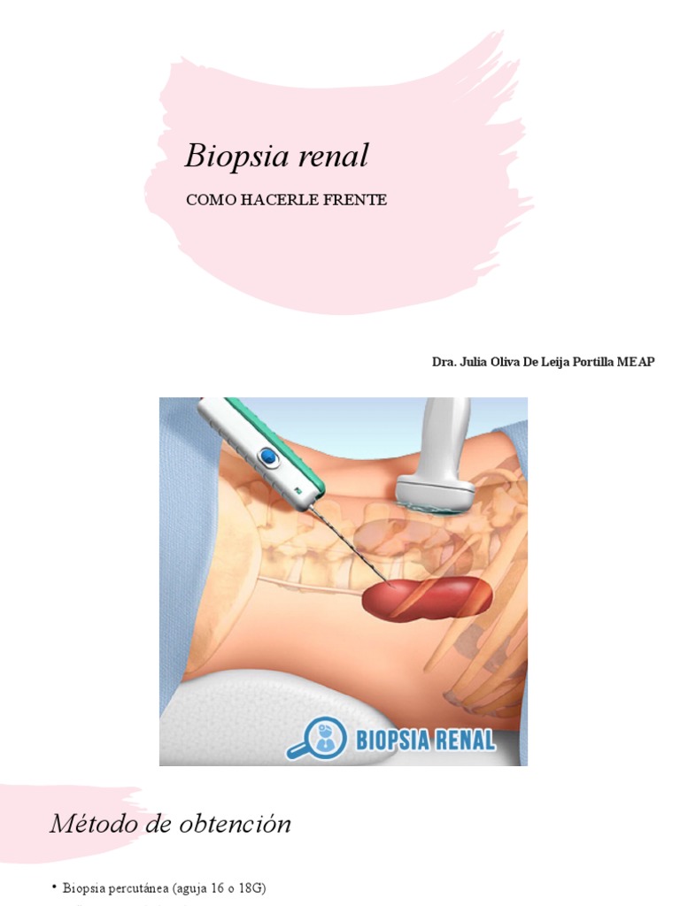 Copie de Biopsia Renal - 014307 | PDF | Inflamación | Especialidades Medicas