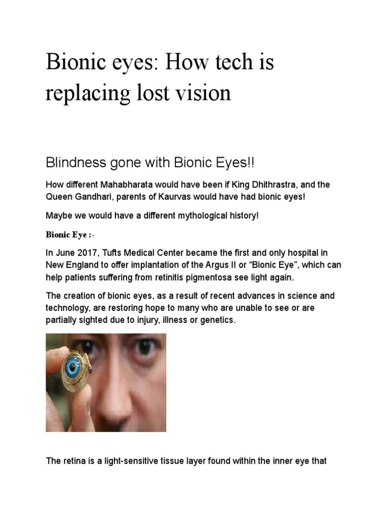 Bionic Eyes: How Tech Is Replacing Lost Vision | PDF
