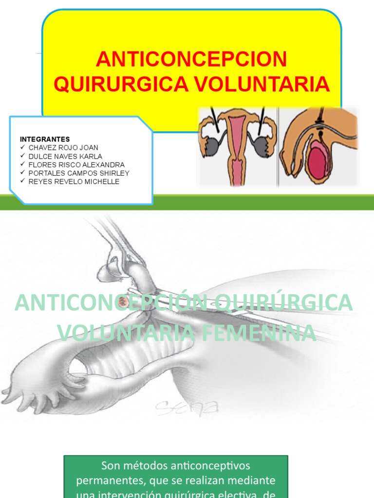 Anticoncepcion Quirurgica Voluntaria | PDF | El embarazo | Parto