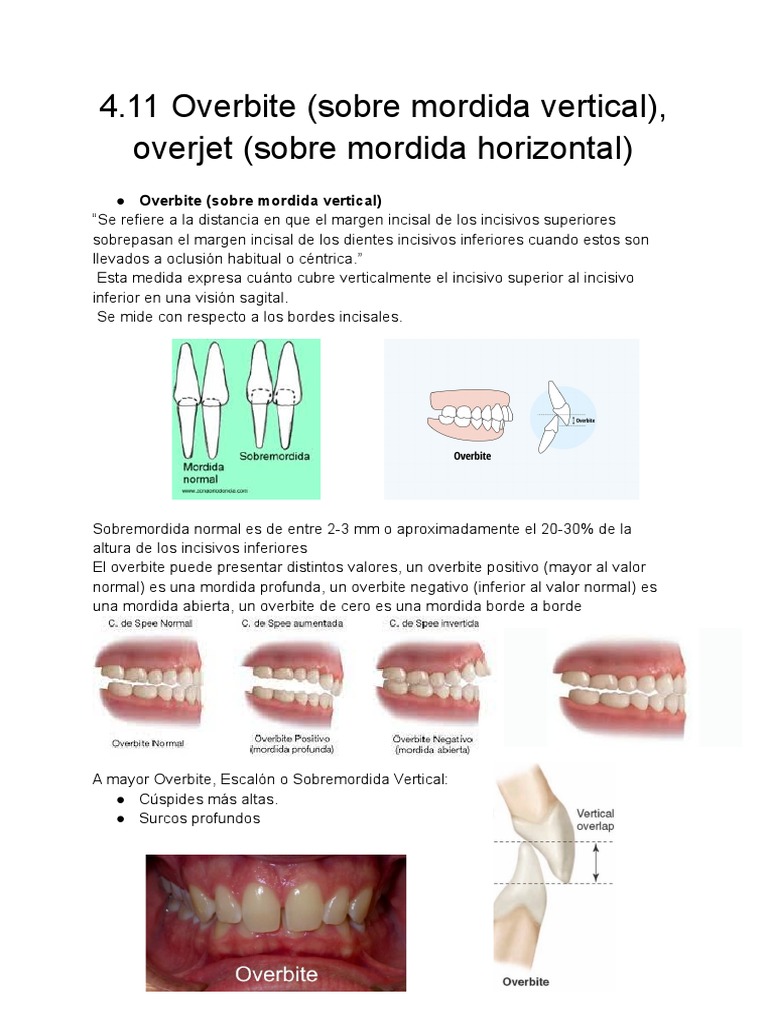 4.11 Overbite Overrjet | PDF | Crecimiento personal y profesional