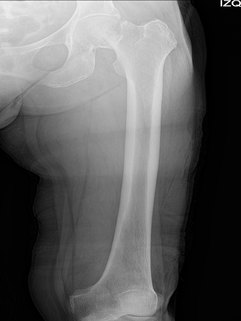 Femur-Ap. | PDF