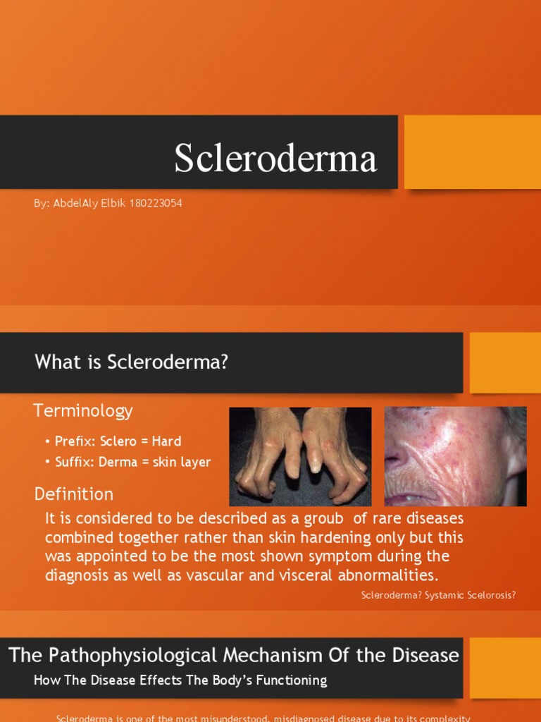 Scleroderma | Download Free PDF | Epidemiology | Medicine