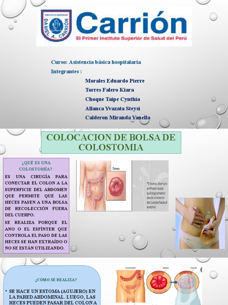 Guía de colocación de colostomía y sondas | PDF | Cáncer colonrectal ...