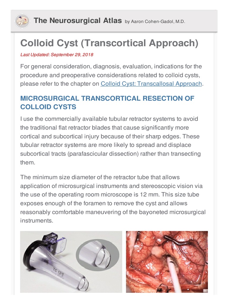 Colloid Cyst (Transcortical Approach) | PDF | Cerebrospinal Fluid ...