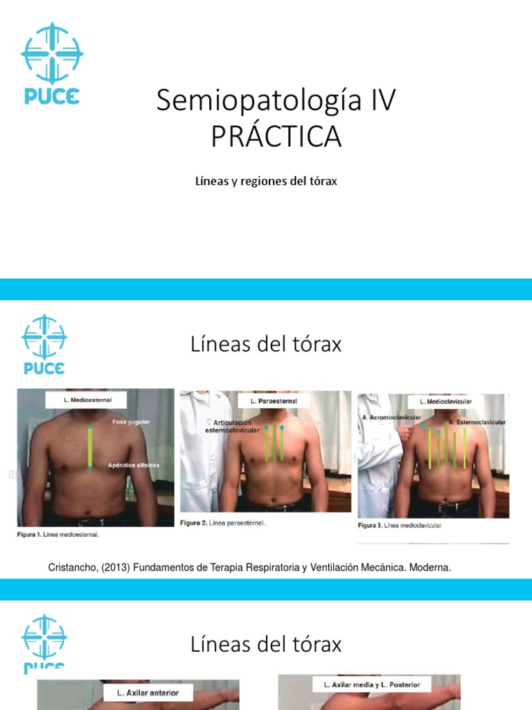 Líneas y Regiones Del Tórax | PDF