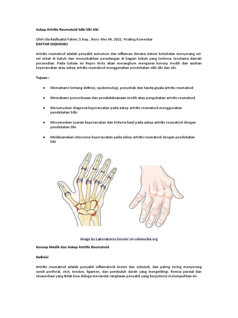 Askep Artritis Reumatoid: Panduan Keperawatan | PDF