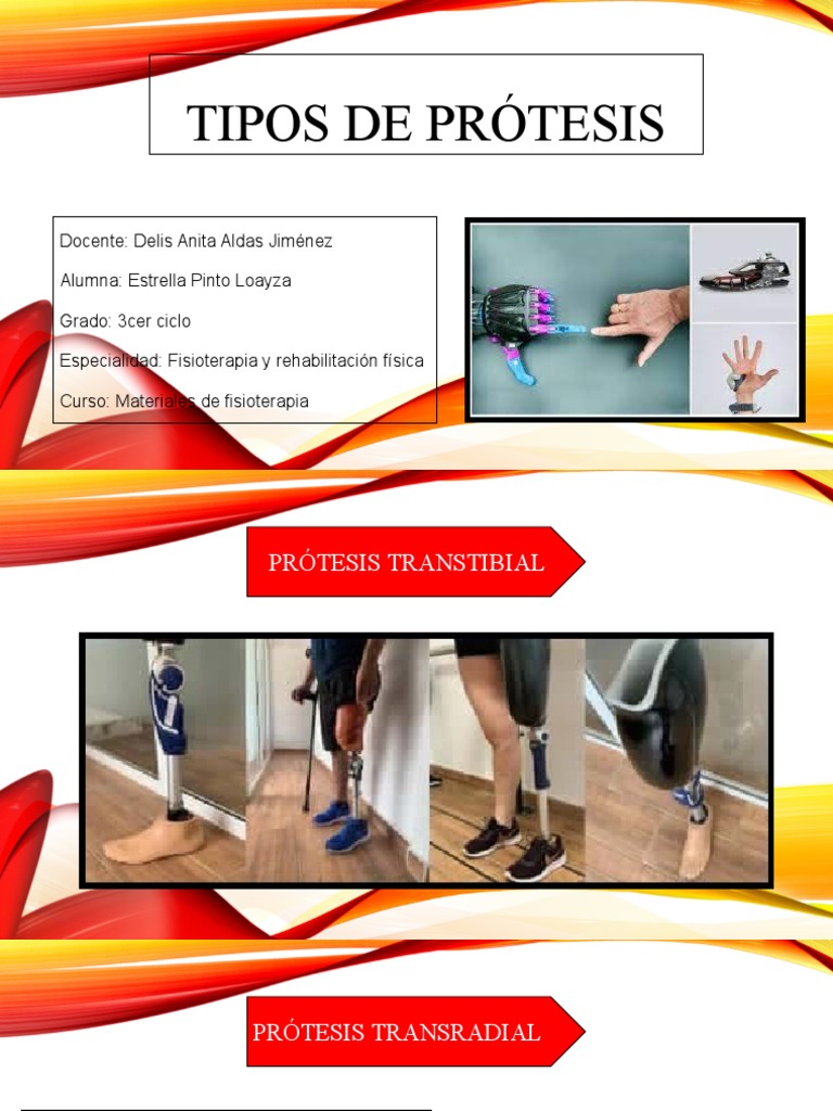 Diferentes tipos de prótesis y sus aplicaciones | PDF