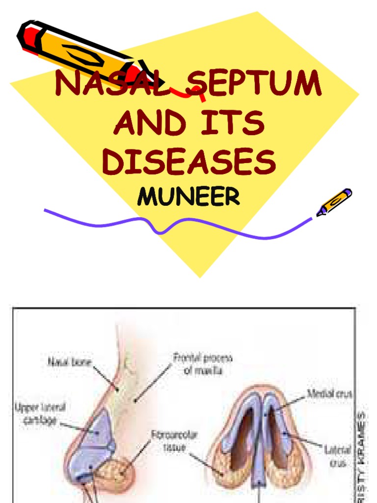 Nasal Septum Diseases | PDF | Human Nose | Bleeding