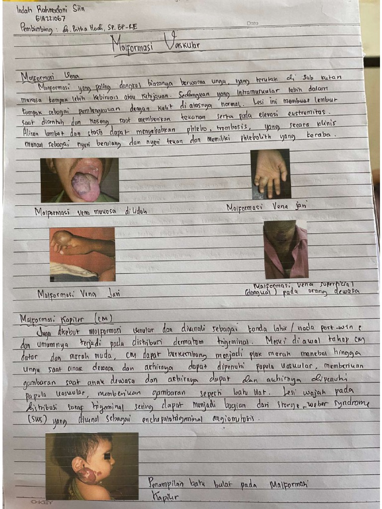 Malformasi Vaskular | PDF