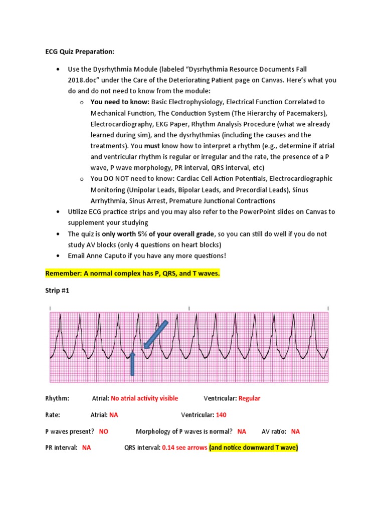Preparing for the ECG Quiz: A Guide to Interpreting Rhythm Strips and Understanding Common ...