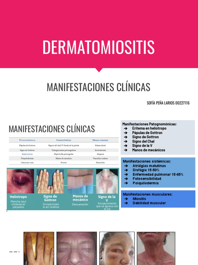 DERMATOMIOSITIS | PDF