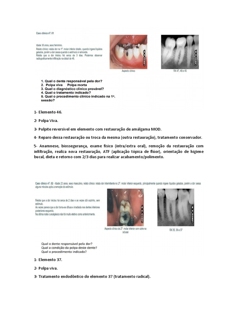 endo (casos) | PDF | Dente | Medicina Clínica