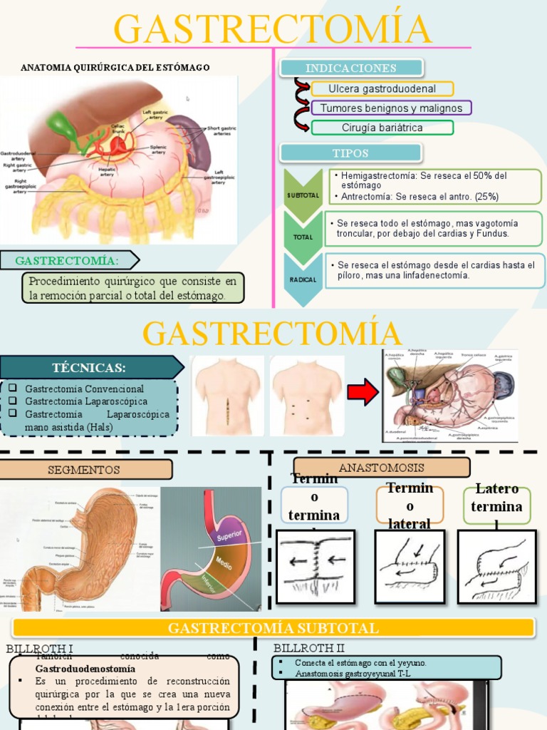 GASTRECTOMIA | PDF | Estómago | Medicina
